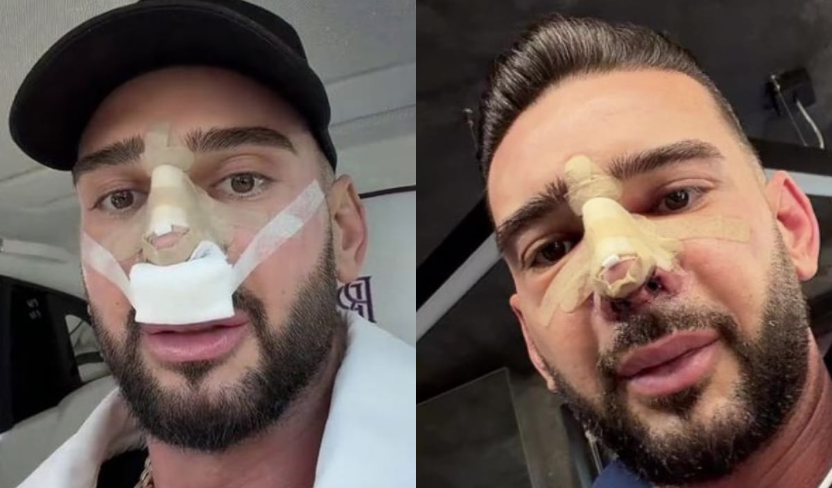 Cum arată nasul lui Dorian Popa la 12 zile de la operație. Și-a dat ...